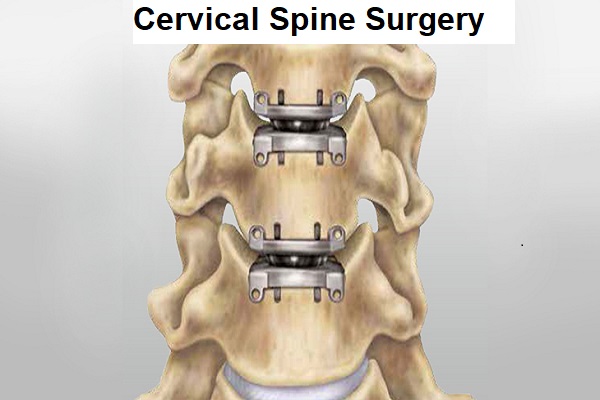 Spine Surgery in Nashik :: Dr. Sanjeev Desai